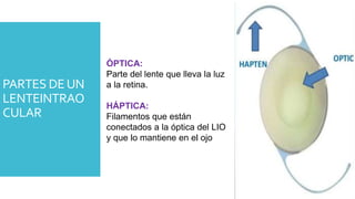 Lentes intraoculares (lio) | PPT