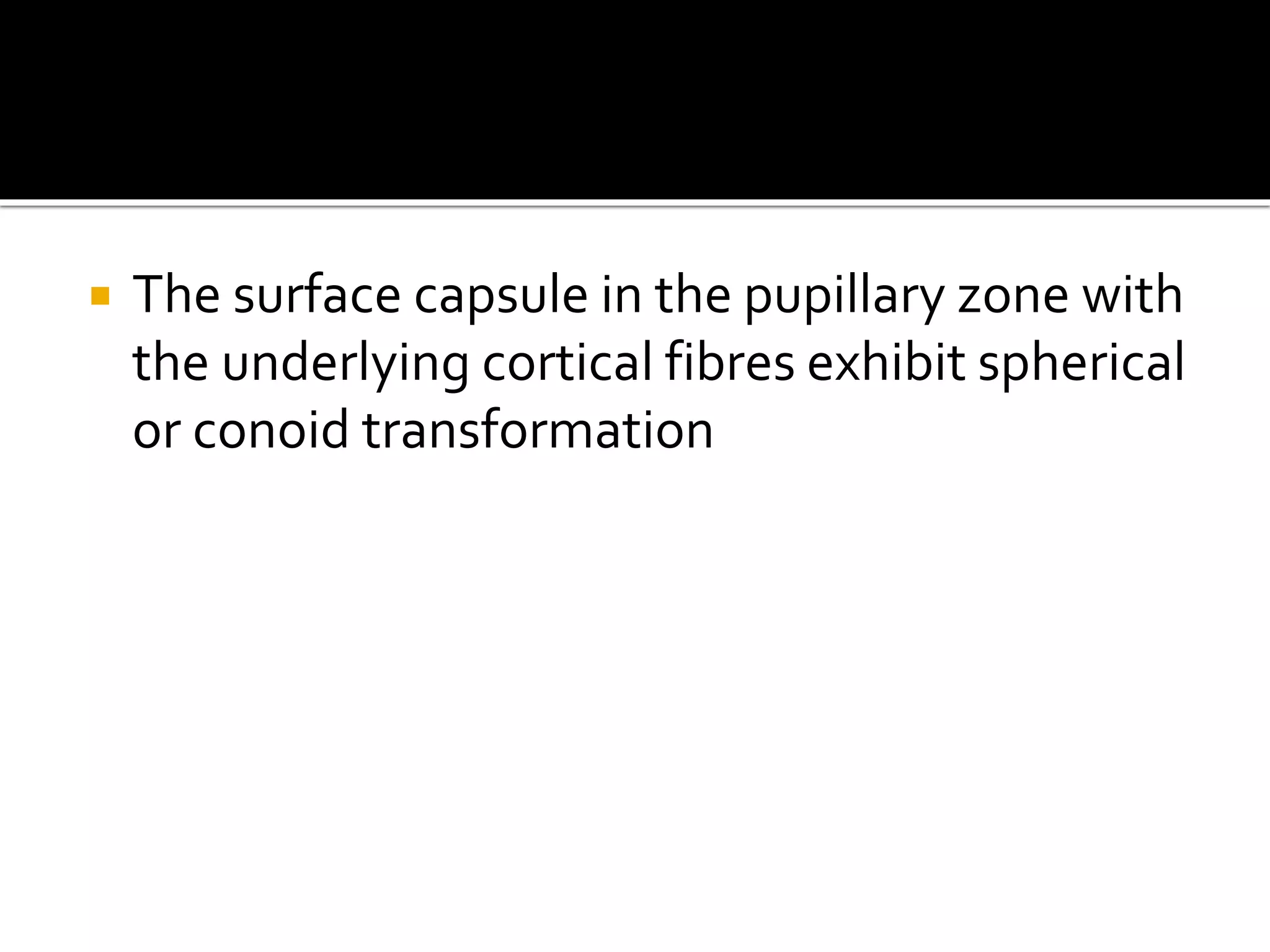Lenticular abnormalities | PPTX