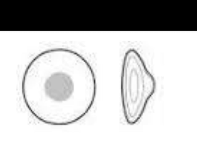 Lenticular abnormalities | PPTX