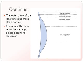 Lenticular lenses | PPTX