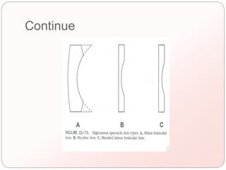 Lenticular lenses | PPTX