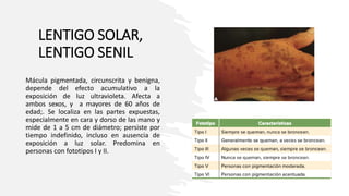 LENTIGO.pptx | Skin and Dermatology | Diseases and Conditions