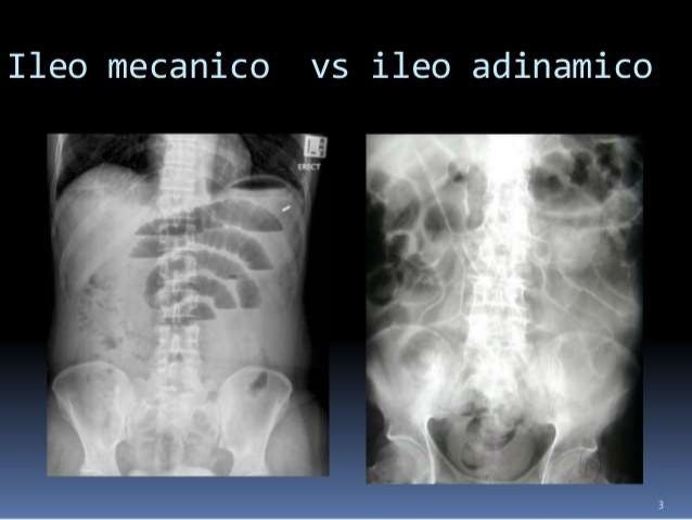 íLeo metabólico y mecánico simple