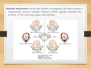 Leopold manuver.pptx