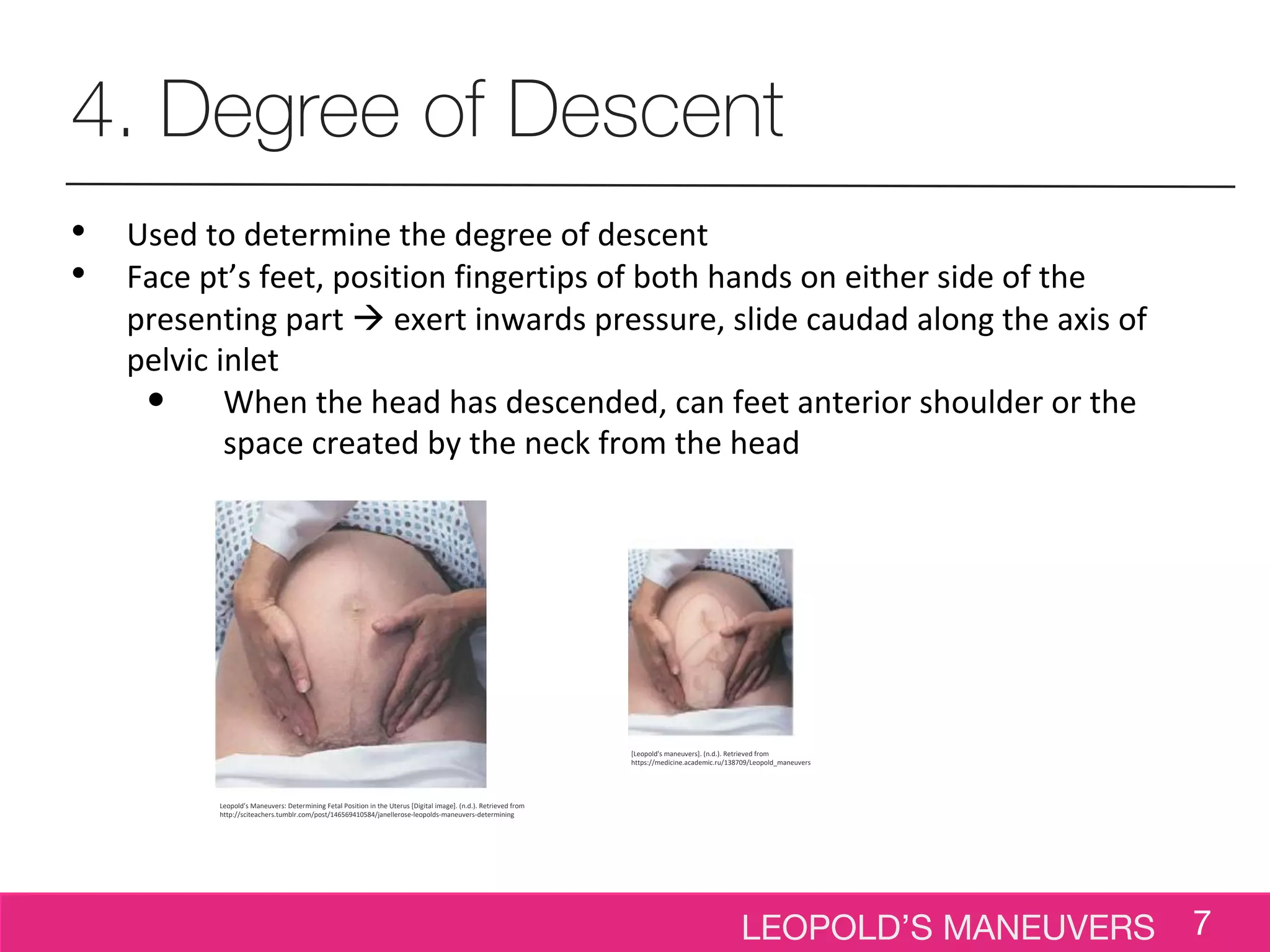 Leopolds-maneuvers-3.pdf