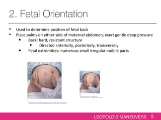 Leopolds-maneuvers-3.pdf