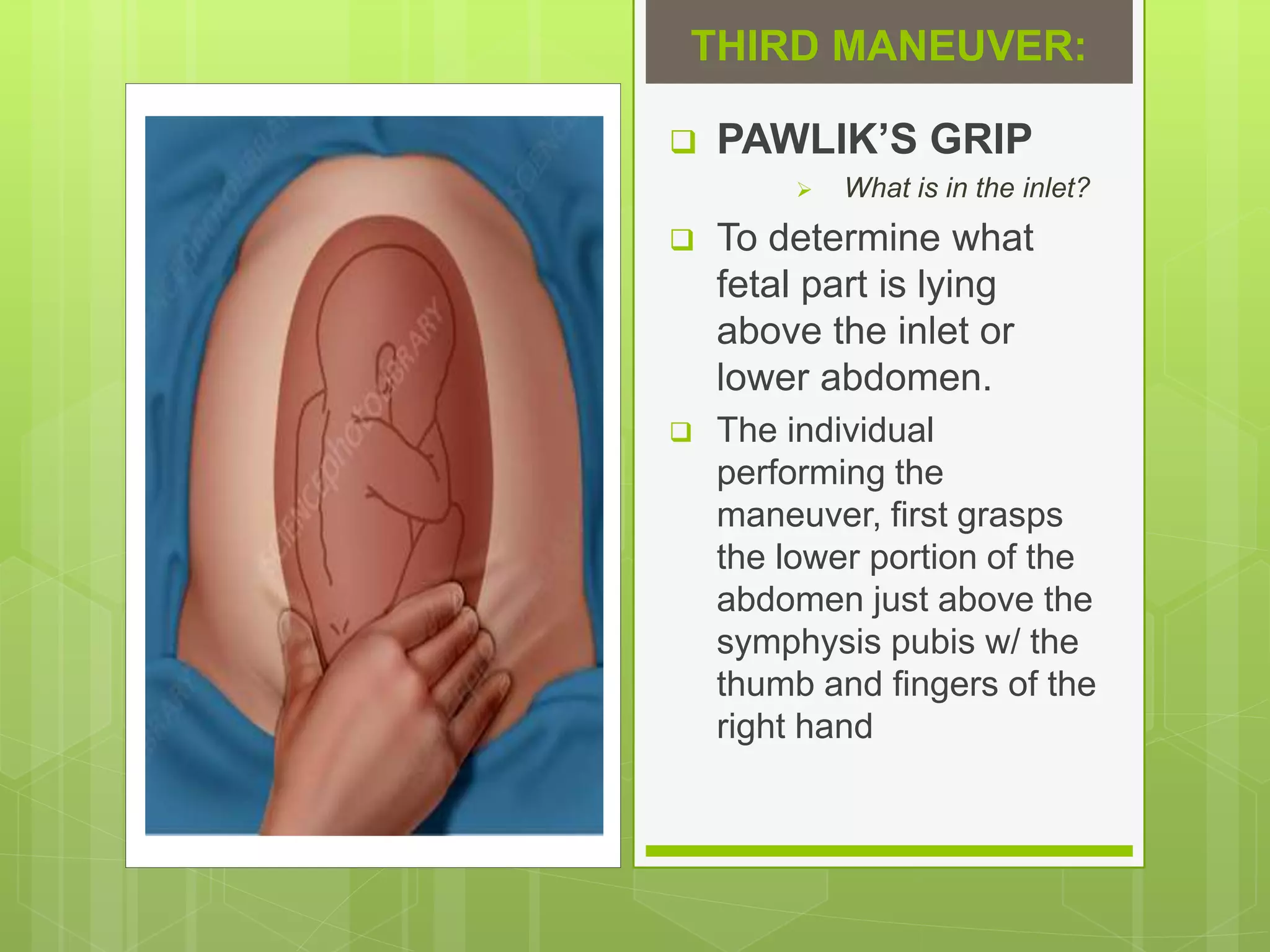Leopold’s Maneuver | PPTX