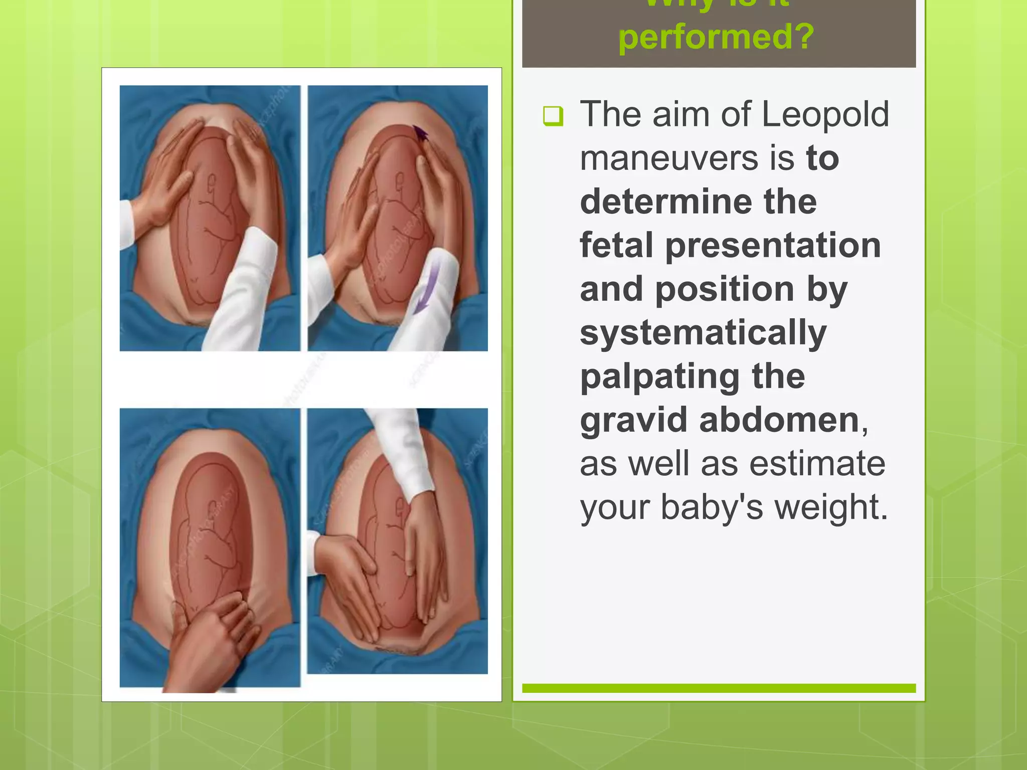 Leopold’s Maneuver | PPTX
