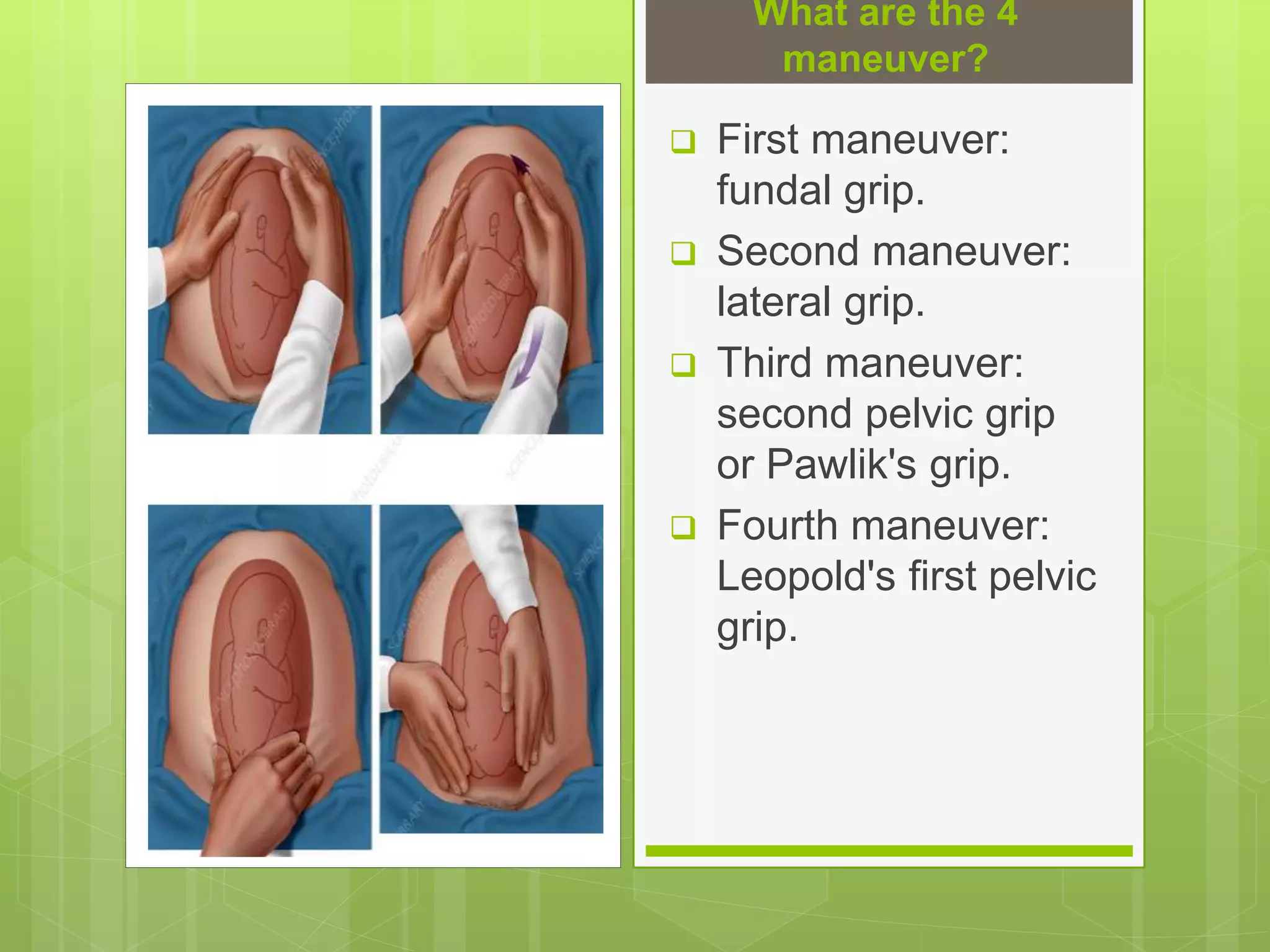 Leopold’s Maneuver | PPTX