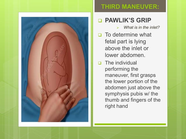 Leopold’s Maneuver | PPTX | Pregnancy | Reproductive Health