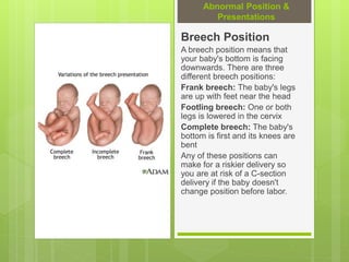 Leopold’s Maneuver | PPTX