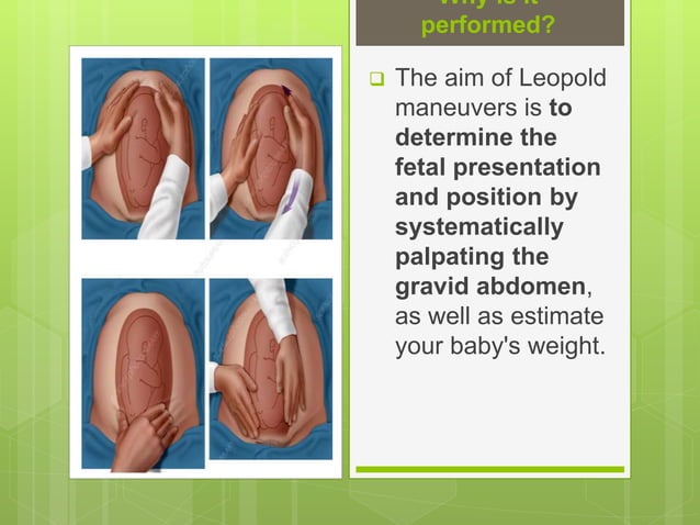 Leopold’s Maneuver | PPTX | Pregnancy | Reproductive Health
