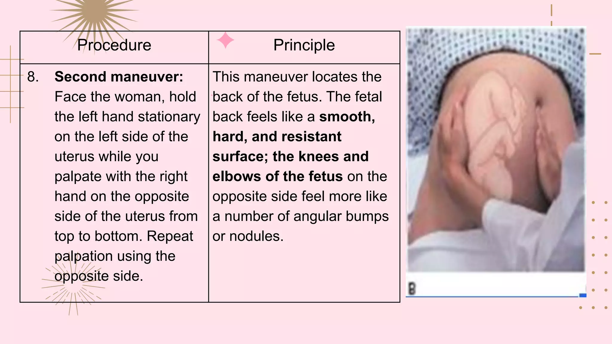 Leopold's Maneuver.pdf
