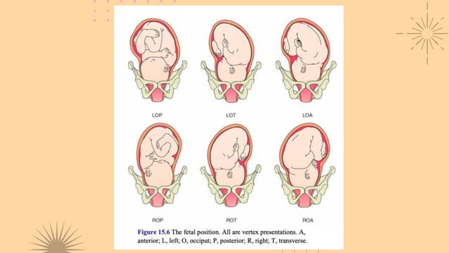 Leopold's Maneuver.pdf