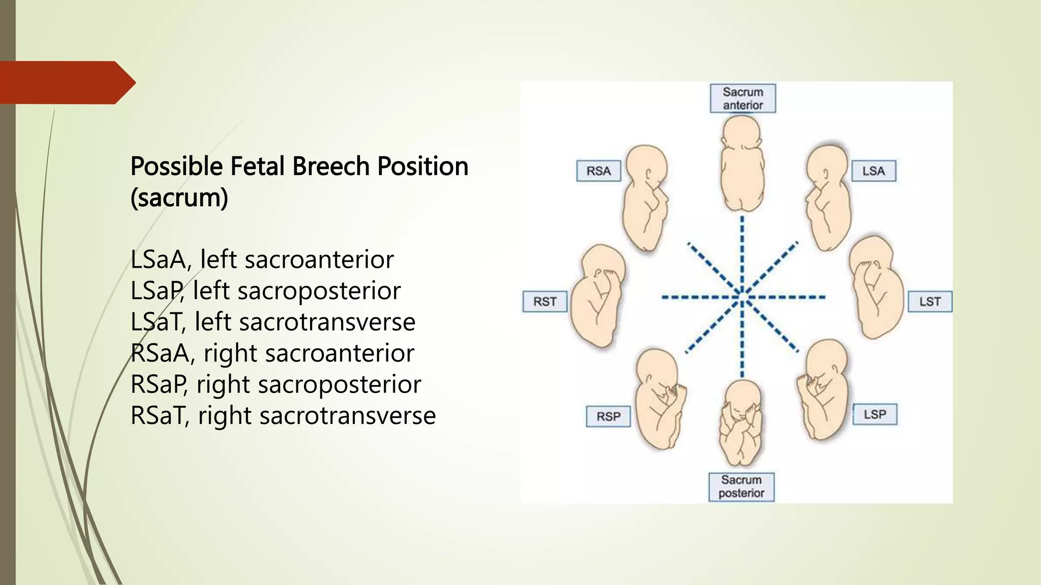 LEOPOLD'S MANEUVER.pptx