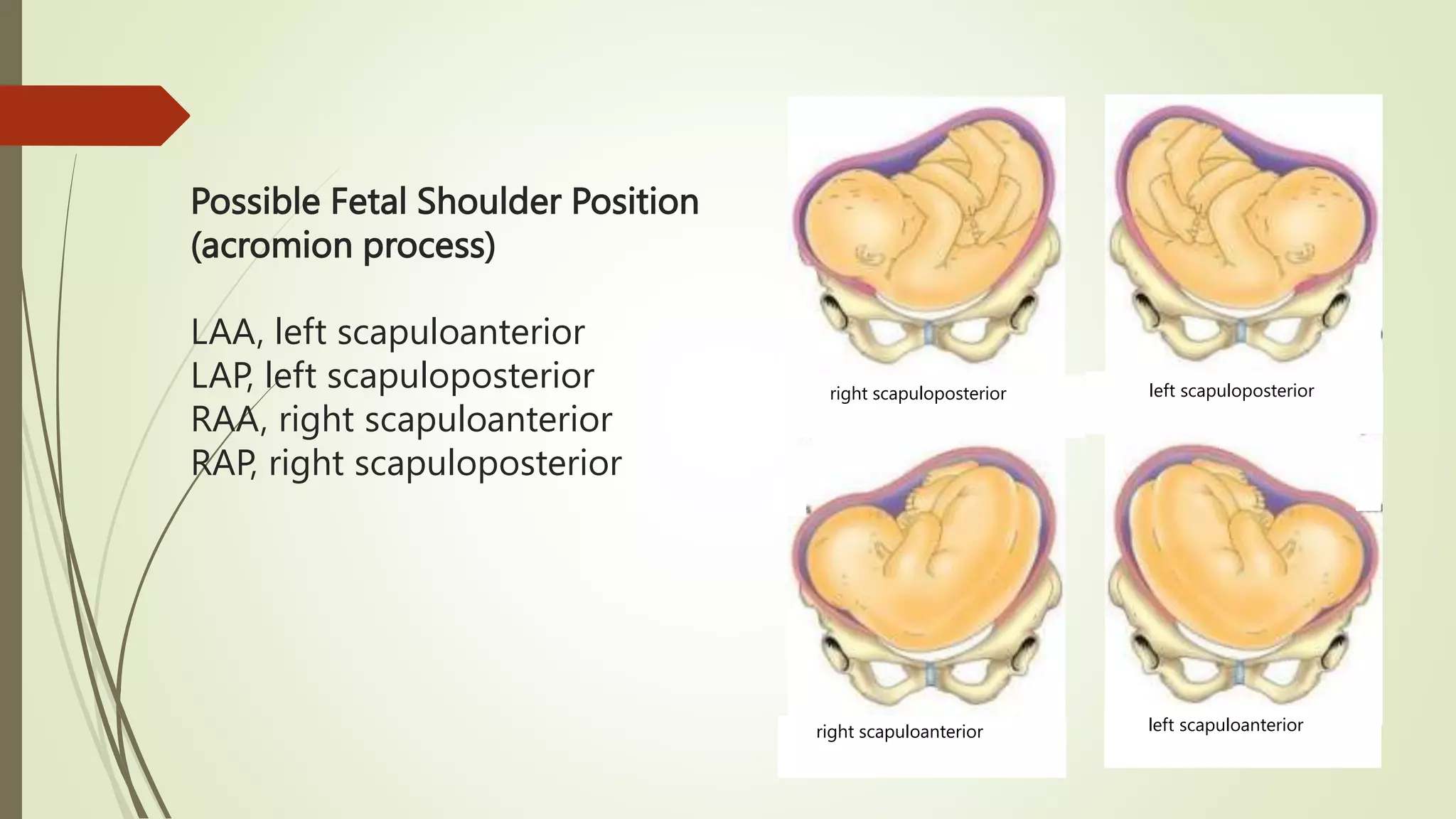 LEOPOLD'S MANEUVER.pptx | Pregnancy | Reproductive Health