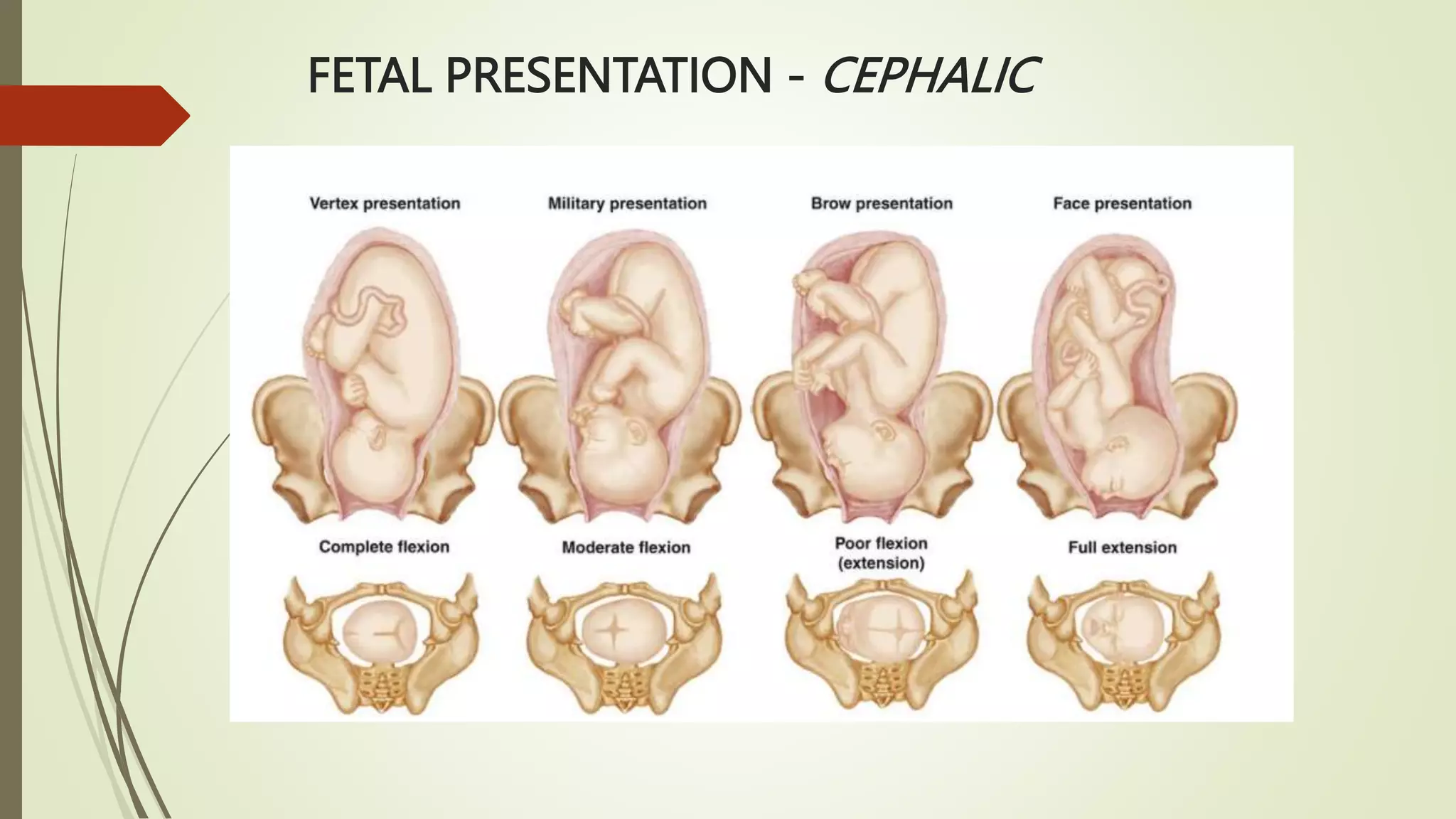 LEOPOLD'S MANEUVER.pptx