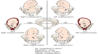 LEOPOLD'S MANEUVER.pptx