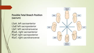 LEOPOLD'S MANEUVER.pptx | Pregnancy | Reproductive Health