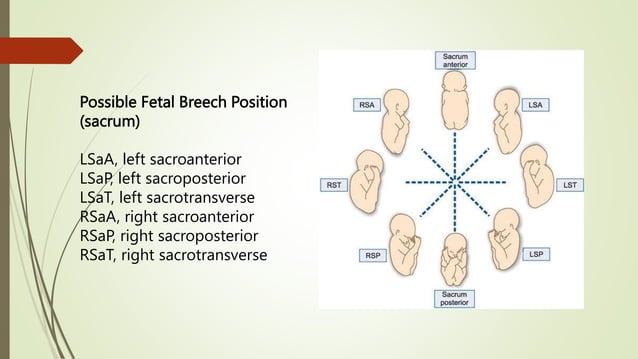 LEOPOLD'S MANEUVER.pptx | Pregnancy | Reproductive Health