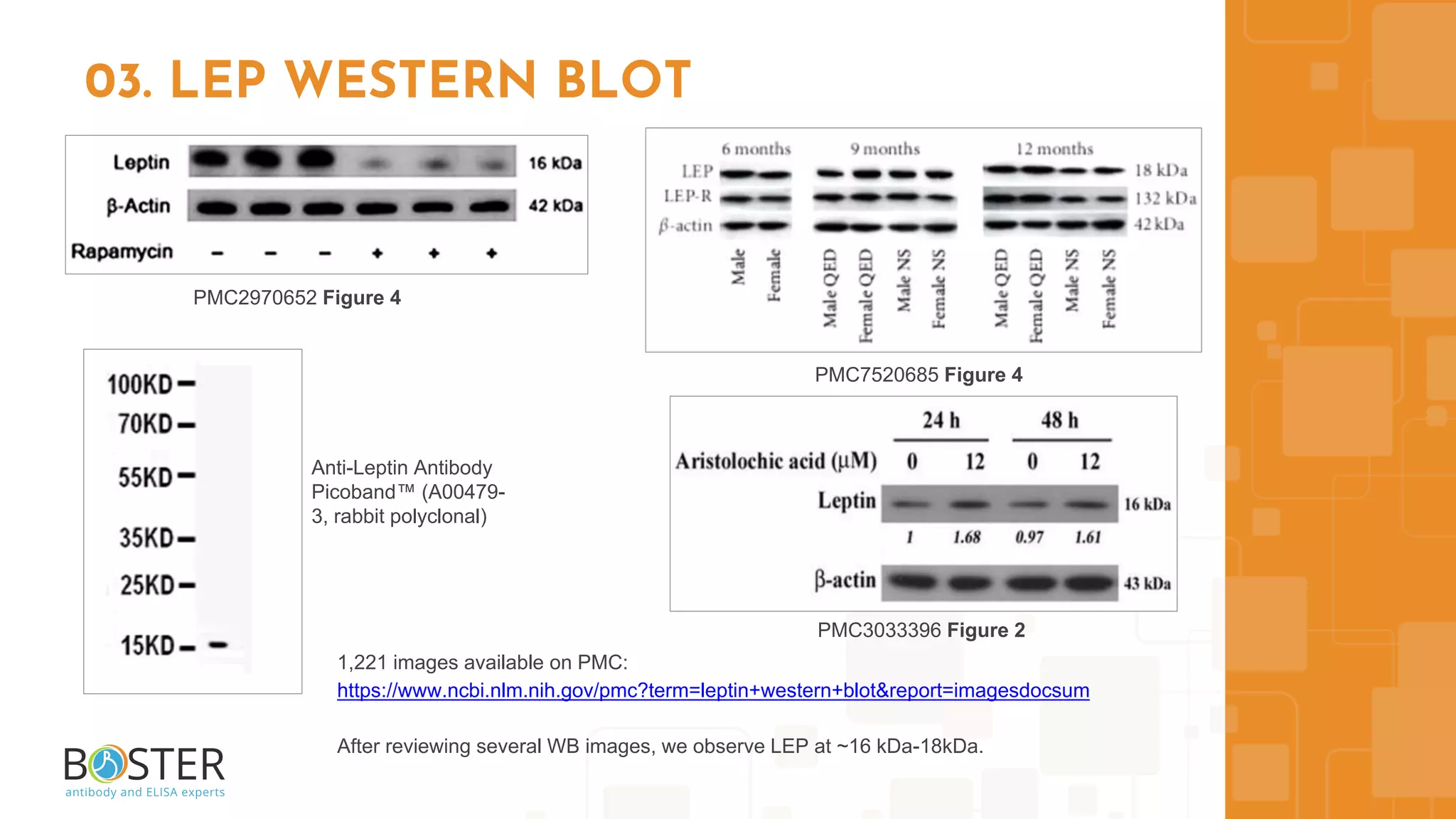 Learn LEP in 3 minutes | Leptin | PPTX