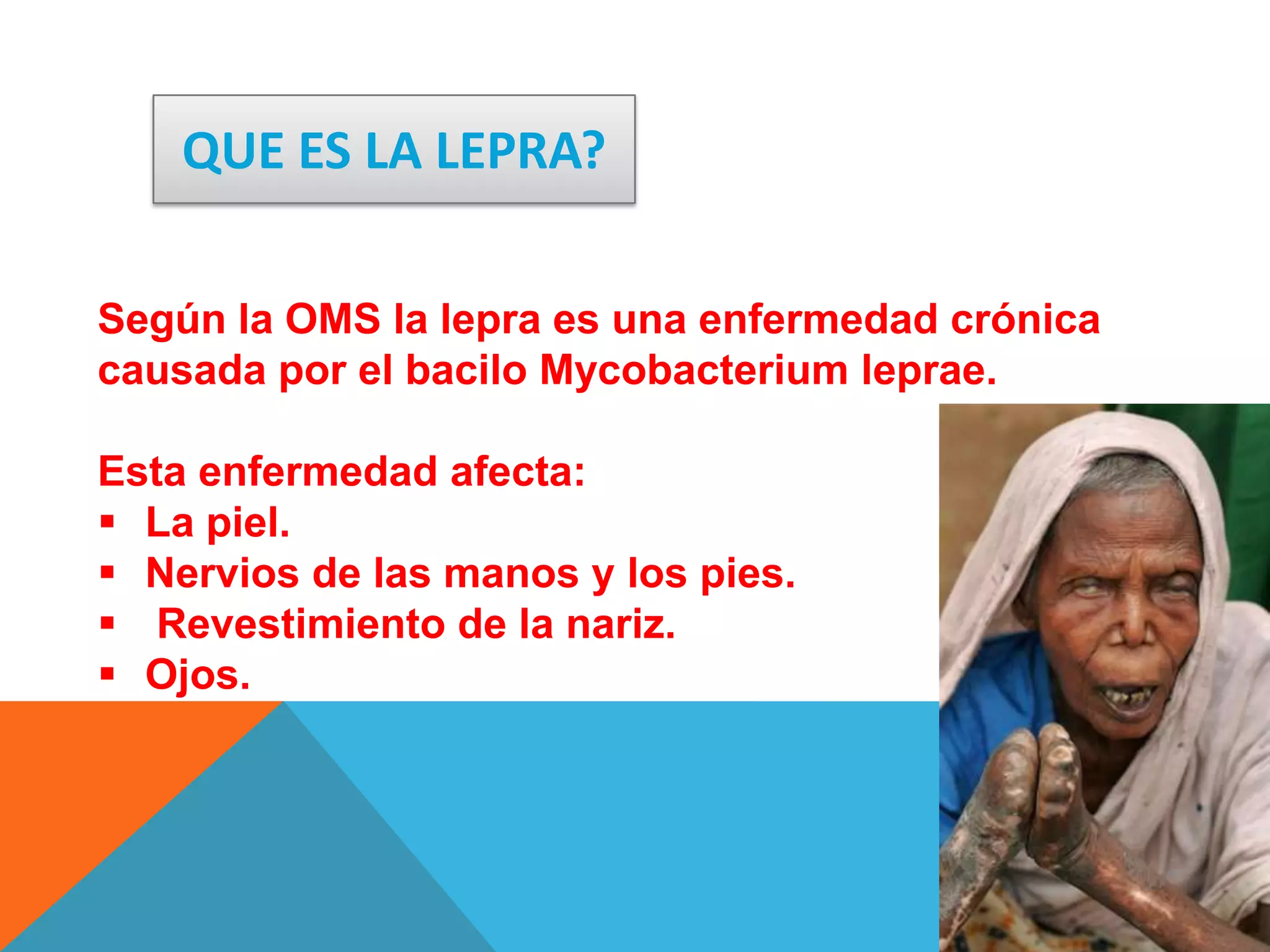 Lepra | PPTX