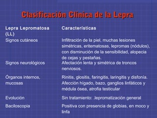 Lepra | PPT