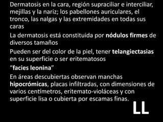 Lepra | PPTX