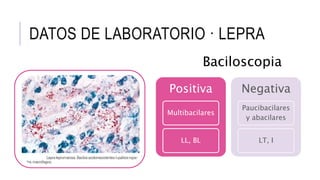 Lepra | PPTX