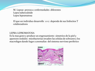 Lepra | PPTX