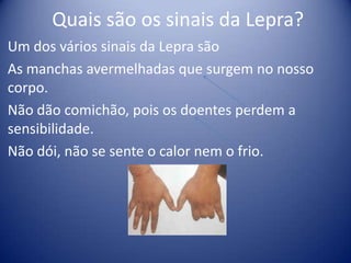 Lepra | PPTX