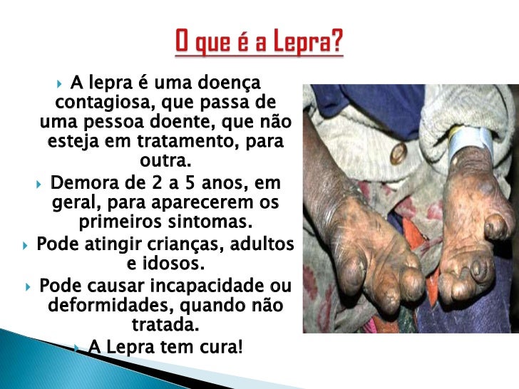 Lepra
