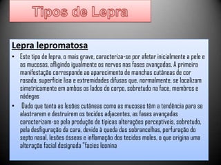 Lepra | PPTX