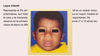 Lepra - Dermatologia_.pptx