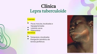 Mycobacterium leprae.pptx