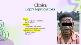 Mycobacterium leprae.pptx