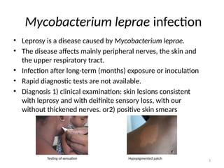Leprae, definition, causes, signs & symptoms | PPT