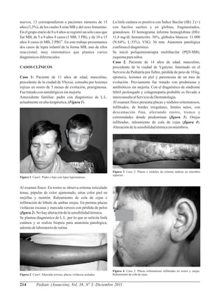 Lepra Multibacilar en Niños | PDF