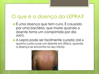 Leprosos | PPTX