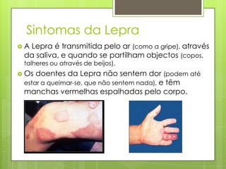 Leprosos | PPTX