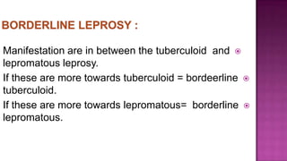 Leprosy | PPTX
