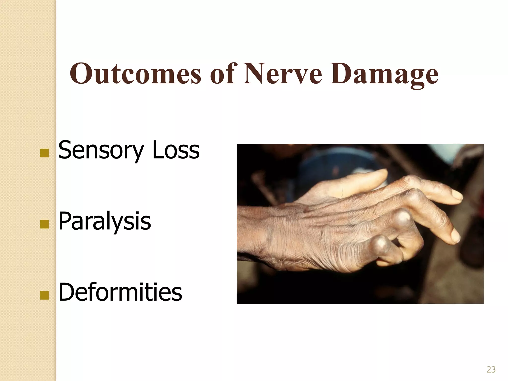 Pathophysiology of Leprosy | PDF
