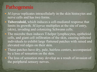 Management of Leprosy | PPTX