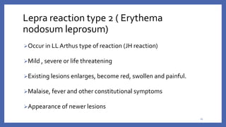 Anti Leprotic Drugs | PPTX