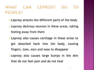 Leprosy | PPTX