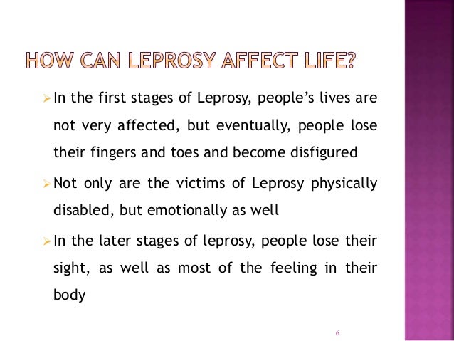 Leprosy