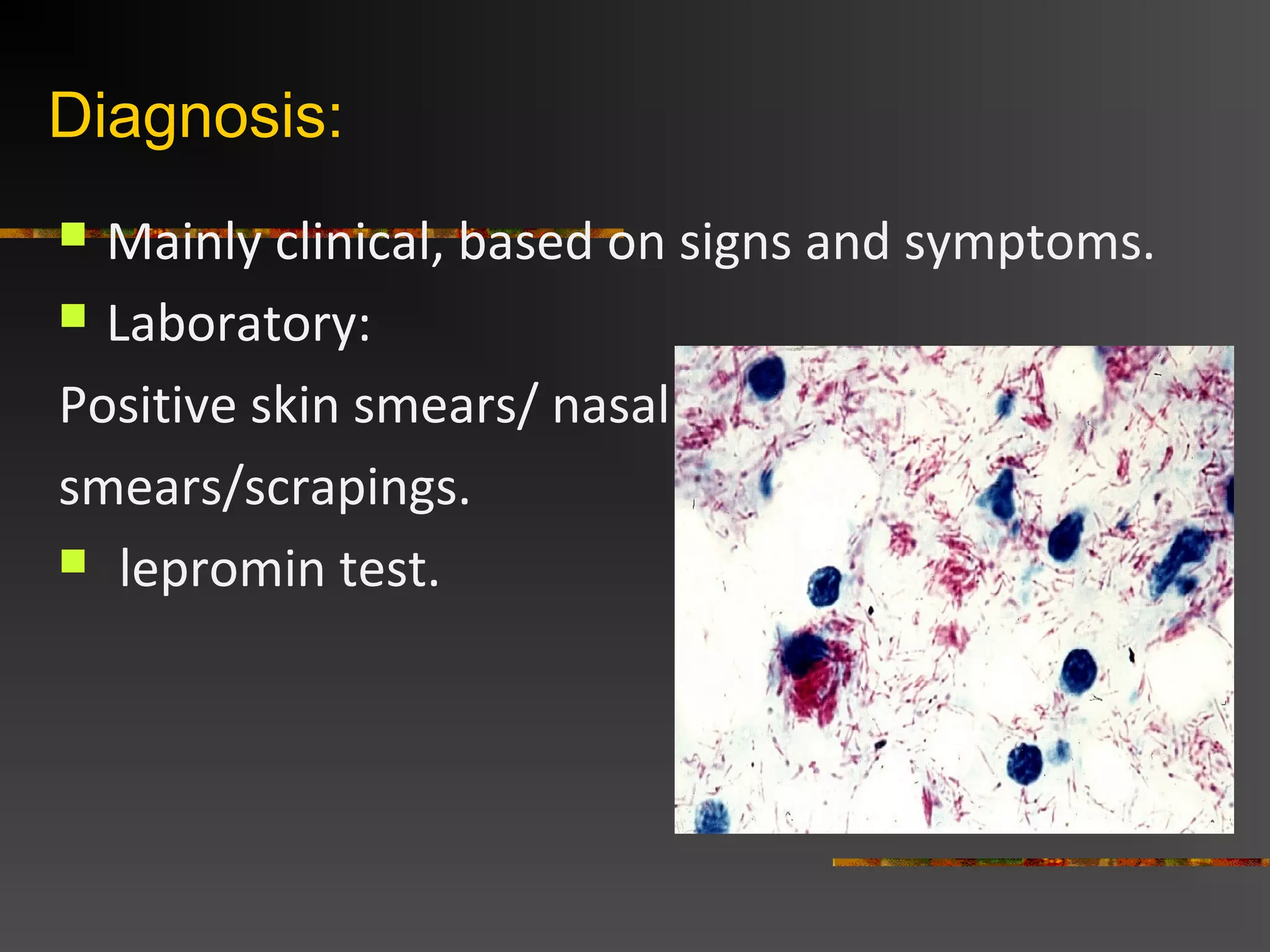 Leprosy | PPT