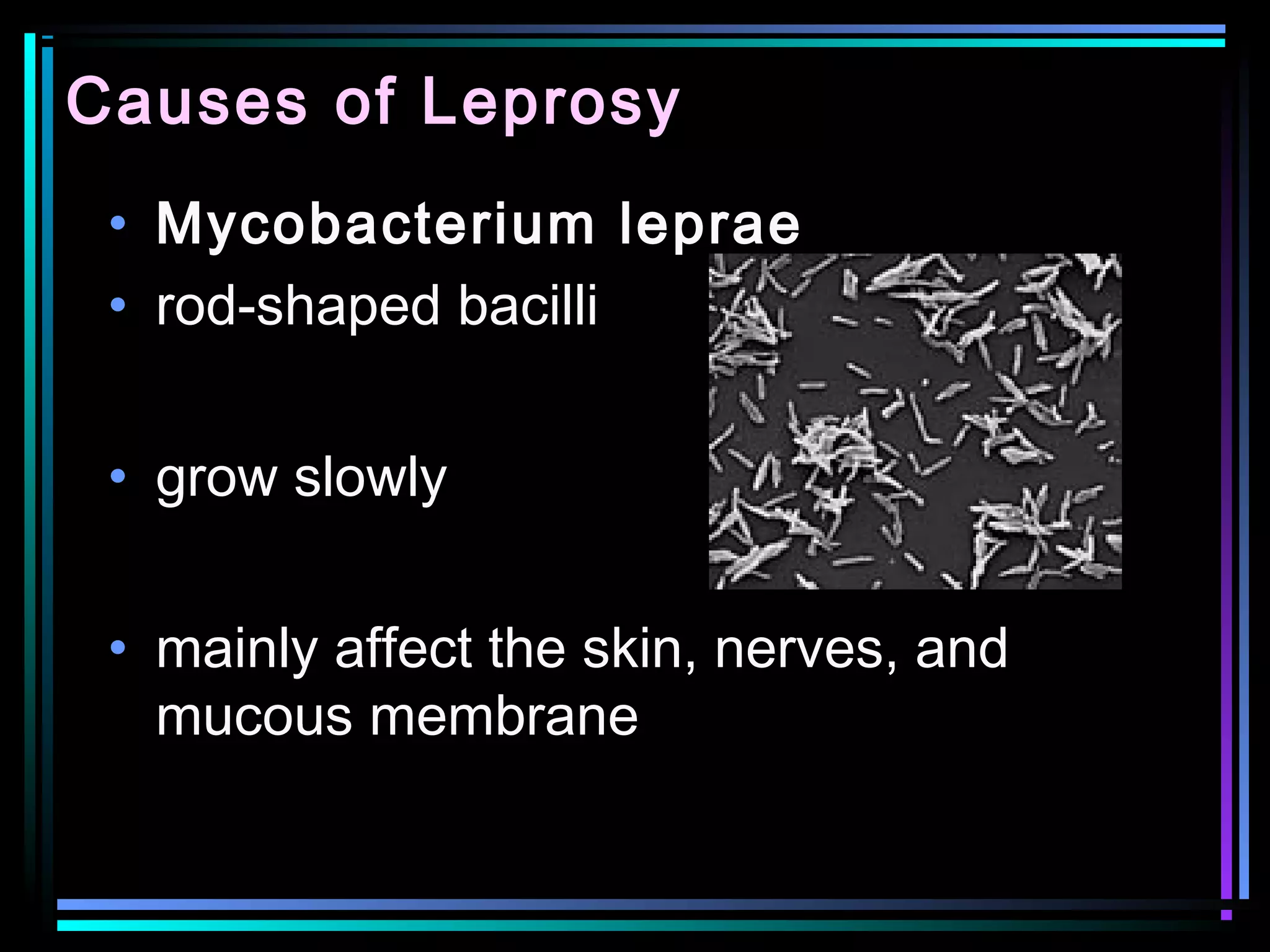 Leprosy | PPT
