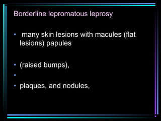 Leprosy | PPT