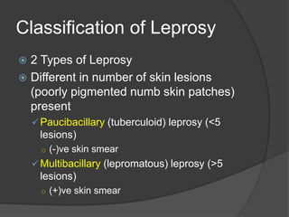 Leprosy - Dr. Julius King Kwedhi | PPT